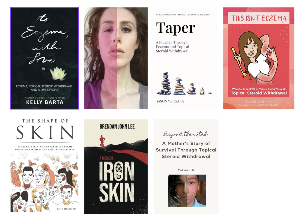 Methods and Routines | TSW Assist | Topical Steroid Withdrawal Insights